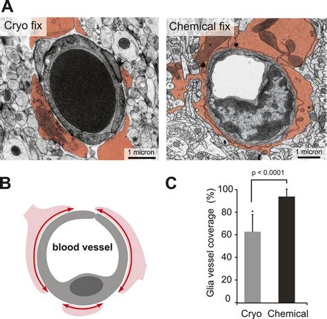 Ultrastructural Analysis Of Adult Mouse Neocortex Comparing Aldehyde Perfusion With Cryo