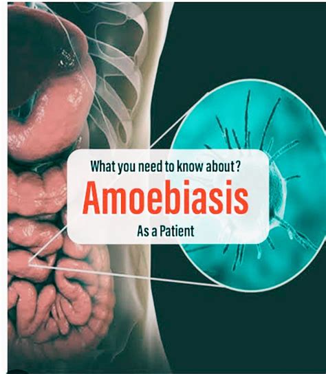 Amebiasis Entamebiasis