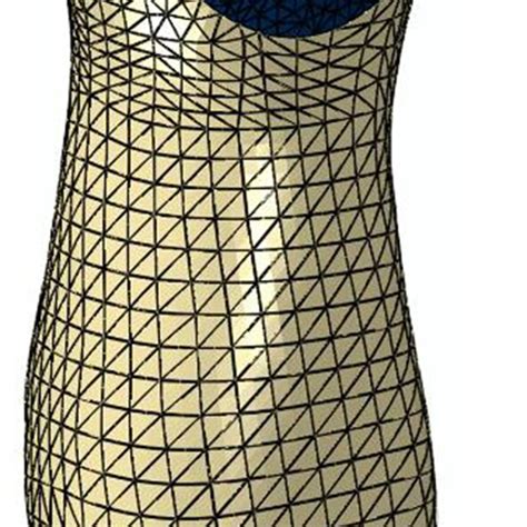 In The Segmentation Module The Bone Structure Was Selected By Download Scientific Diagram