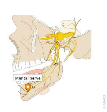 Mental Nerve E Anatomy Imaios