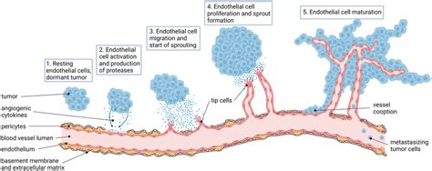 Angiogenesis Is A Hallmark Of Cancer1 When A Dormant Tumor Undergoes