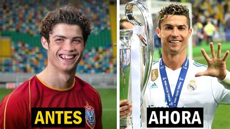 12 Futbolistas Antes Y Después De Sus Cirugías ¡la Diferencia De
