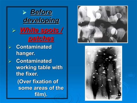 7 Errors Of Dental X Ray Might Happen Ppt