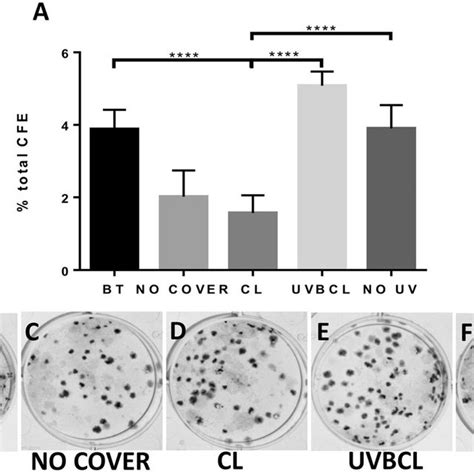 Senofilcon A Uvb Blocking Contact Lenses Prevent Modifications In The