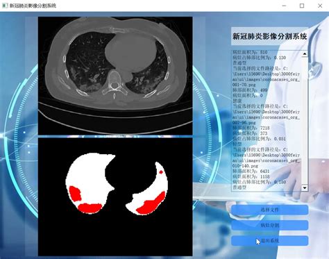 改进unet的新冠肺炎ct影像病灶分割系统（部署教程和源码）ma Unet 肺分割数据集 Csdn博客