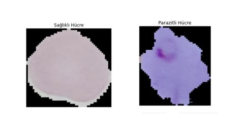 Image Segmentation Using U Net Image Segmentation Is A Process Used To