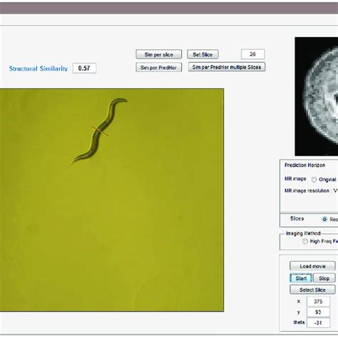 Graphical User Interface Of A Matlab Program That Simulates The Mr
