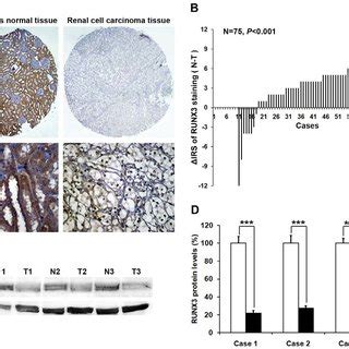 RUNX3 Protein Expression In RCC Tissues And Paired Non Cancerous Download Scientific Diagram