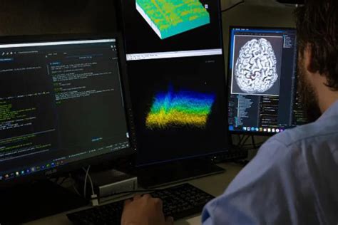 역사적 과학적 돌파구 고급 Als 환자는 뇌 임플란트 덕분에 의사 소통을 할 수있었습니다 Infobae