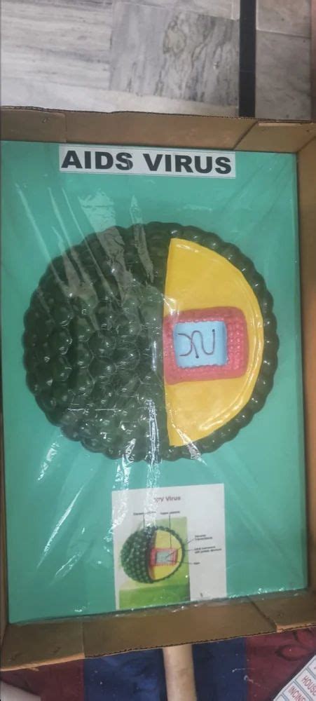 Aids Virus Pathology Model At ₹ 2500 In Ambala Id 2853230309648