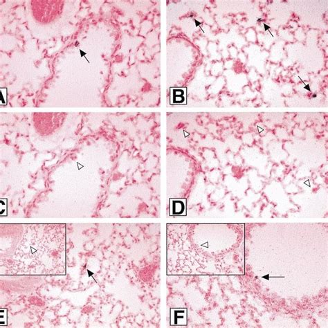 Serial Lung Sections From Bleomycin A F Or Saline Not Shown