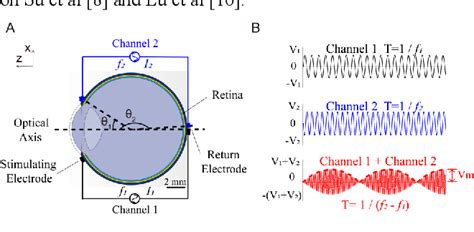 Figure 1 From Improving Spatial Resolution And Selectivity Of Transcorneal Electrical