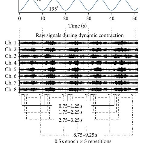 Example Of Emg Signals During Dynamic Contraction The Subjects Five Download Scientific