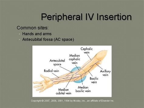 Vascular Access Dr Mueen Ullah Khan Associate Professor