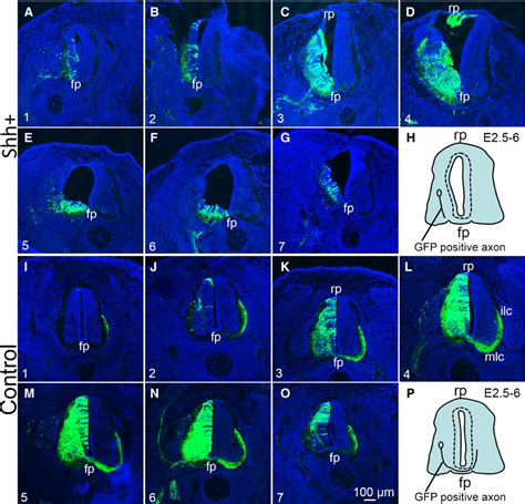 The Effect Of Shh Ectopic Expression On Commissural Axon Projections In