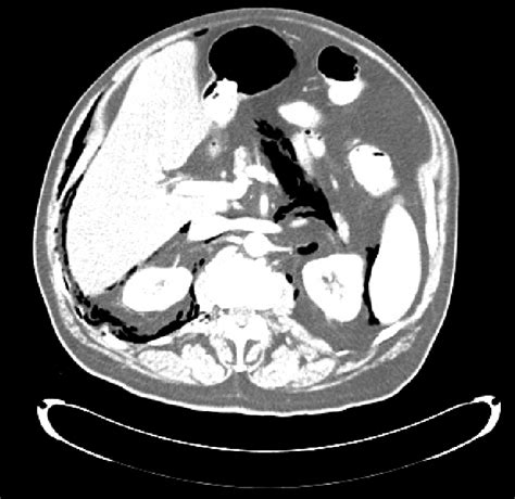 Computed Axial Tomography Scan Of The Patient S Genitalia Which Download Scientific Diagram
