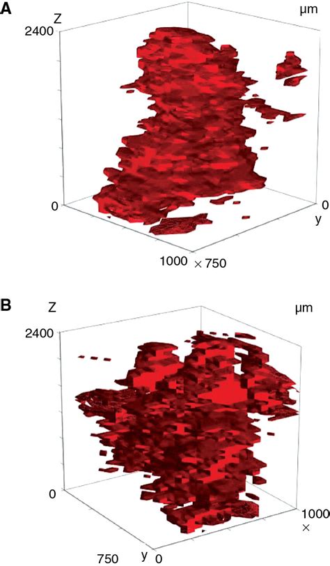 3d Reconstruction Of The Fibrotic Tissue From Segmented Histological