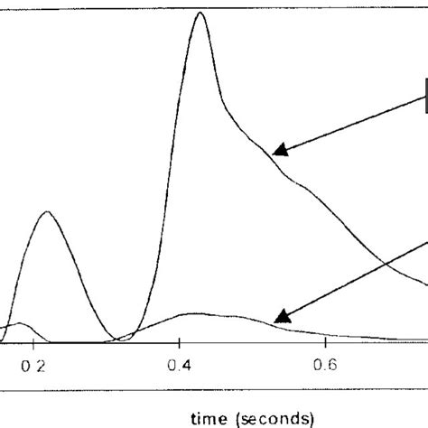 A Cost Function J With And Without Supervision Download Scientific