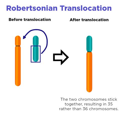Unbalanced Translocation