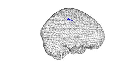 Solving The Eeg Inverse Problem Fieldtrip Toolbox