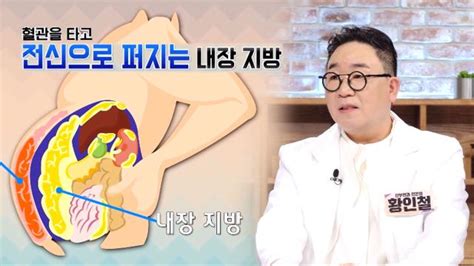 좋은아침 내 뱃살은 염증 공장 악질 중의 악질 ‘내장지방 좋은아침n보건소 Sbs