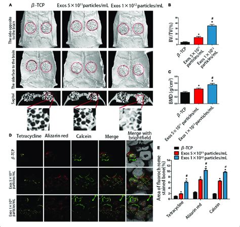The Enhanced Osteogenic Effect Of Exosomeβ Tcp Scaffolds Exosomes Download Scientific