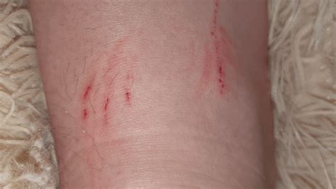 Was I Scratchedbitten By A Turtle Se Qld Aus Rturtle