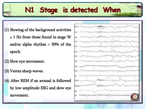 Polysomnogram Interpretetion Pptx