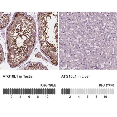 Anti Atg16l1 Human Protein Atlas Antibody