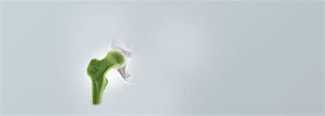 712 Current Concepts In Femoral Stem Fixation And The Paradox In Clinical Practice Winglet