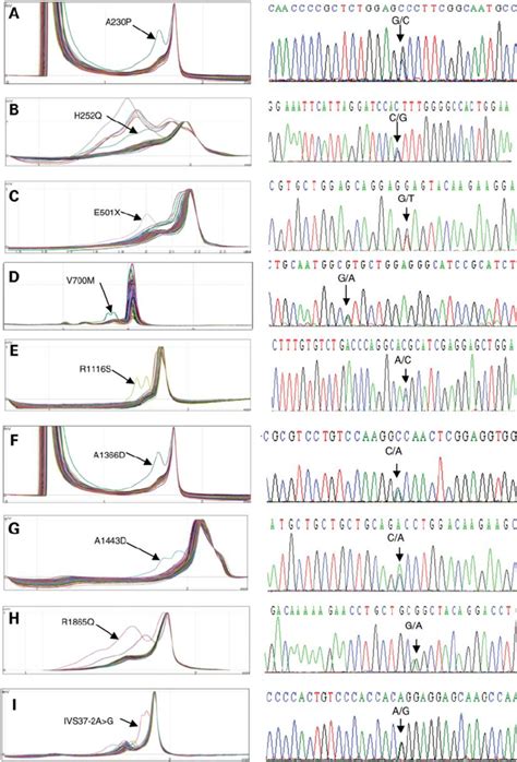 Dhplc And Sequence Traces Showing The Myh6 Mutations Found In The Chd