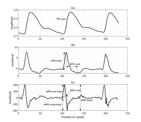 feature extraction from the 1st and 2nd derivative of ppg waveforms