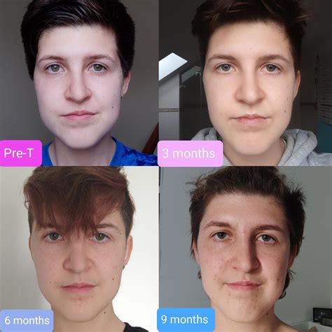 298 Best Chubby Cheeks Images On Pholder Aww Progresspics And Peanut