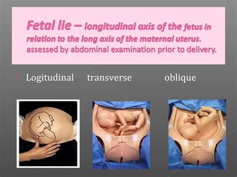 Mcq On Normal And Abnormal Labor For Undergraduate Ppt Pregnancy