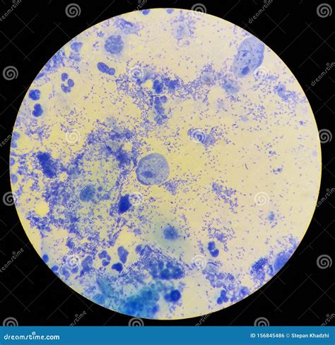 Trichomonas Microscopic View Sexually Transmitted Disease Std Royalty
