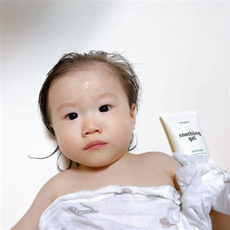 돌아기두드러기 수딩젤로 진정시켜요 네이버 블로그