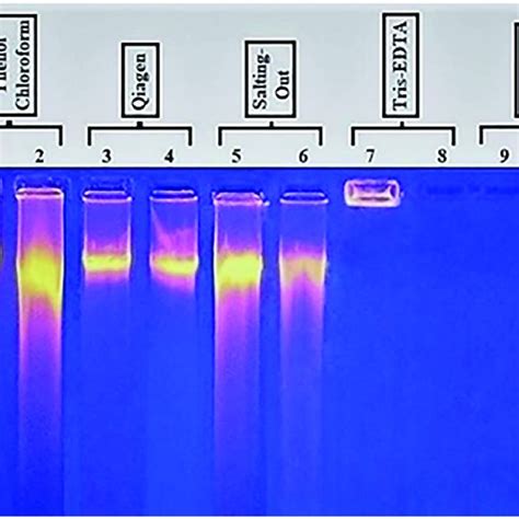 Comparison Of Six Methods Of Loa Loa DNA Extraction Extracted DNA In Download Scientific