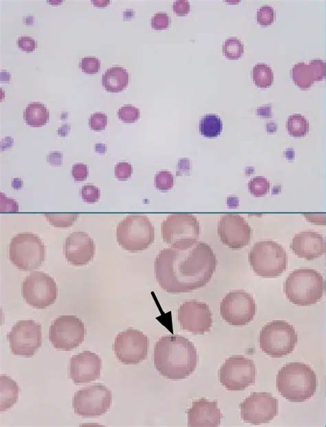 Frotis Sanguíneo Del Perro ¿qué Alteraciones Podemos Encontrar Cuas Formación Veterinaria