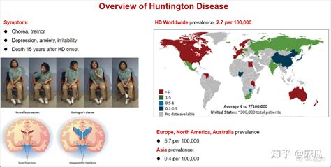 第三个亨廷顿舞蹈症基因治疗临床失败，为什么亨廷顿舞蹈症这么难治？ 知乎