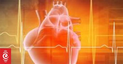 Too Much Work Leads To A Dicky Ticker Rnz