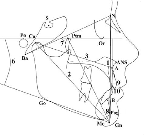 The Landmarks And Measurements Used In Mcnamara Cephalometric Analysis