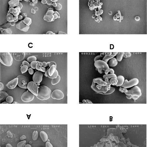 Starch Biosynthesis Pathway In Plants Sucrose Is Converted To Download Scientific Diagram
