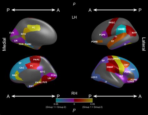 Using Freesurferstatsurfdisplay Freesurferstatsurfdisplay