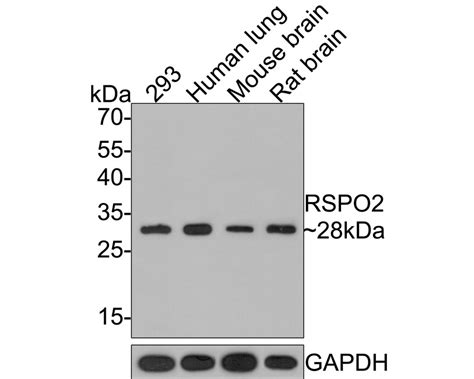 Rspo2 Rabbit Polyclonal Antibody Ha500455 Huabio