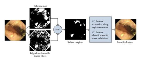 Ulcer Detection Scheme Described In 4 Download Scientific Diagram