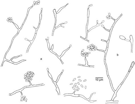 Phialemonium Obovatum Atlas Of Clinical Fungi