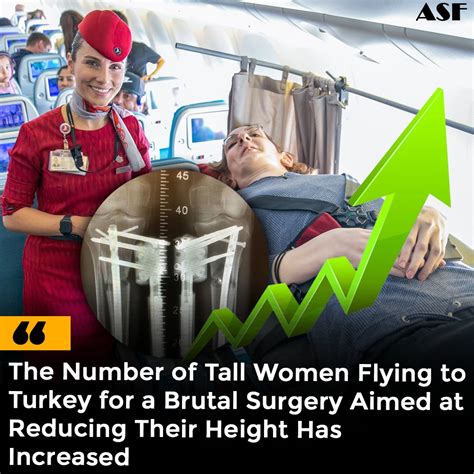 Amazing Clinics In Turkey Report Growing Demand For Height Reduction