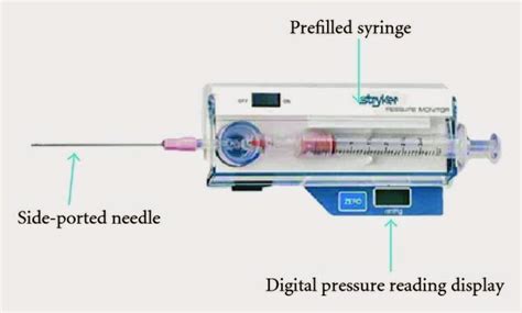 Procedures Club Compartment Pressure Measurement Stryker It