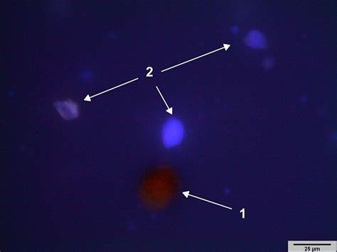 Micrograph ×200 Of Sample A Under Uv Light The Brown Particle 1 Is Download Scientific