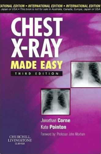 Chest X Ray Made Easy E Book 3rd Edition Ctsqena